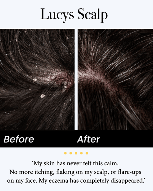 Seb Natural Calming Serum – Seb Skincare